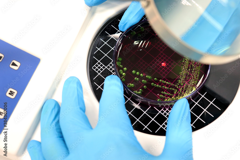 Scientist counted the bacteria colony of Escherichia coli (E.coli ...