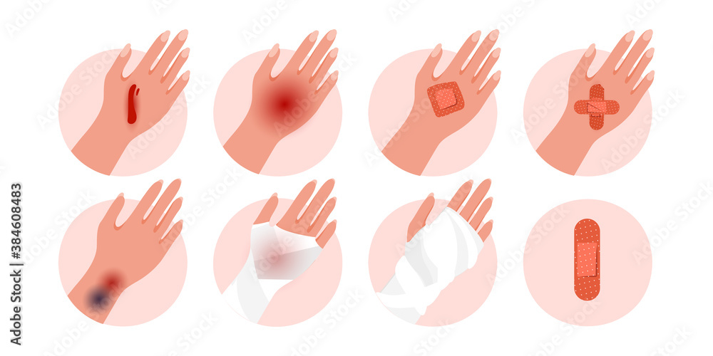 Human body parts of a physical injury with contusion, bruise open cut ...