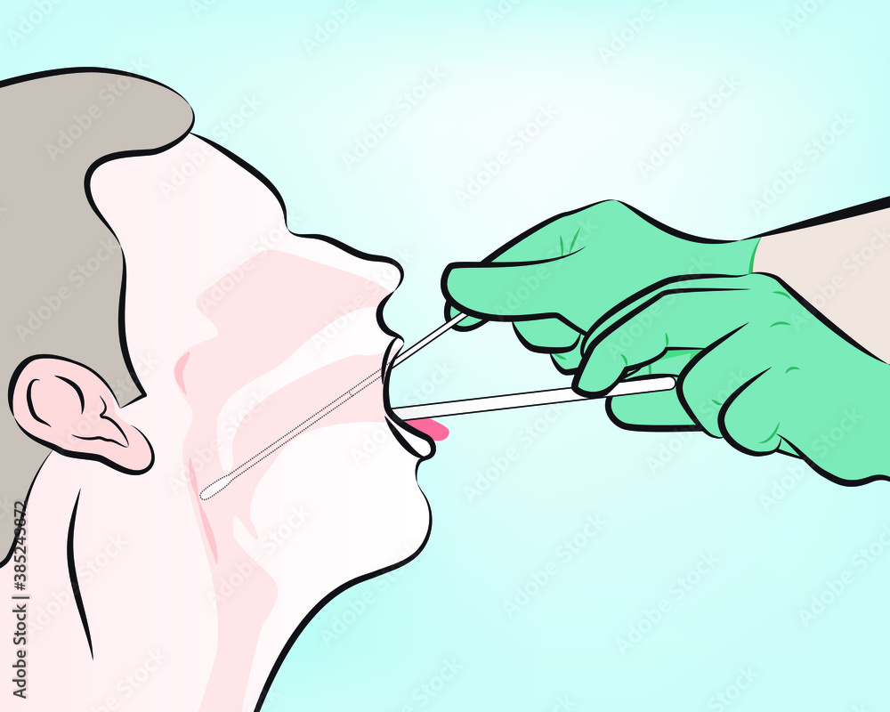 step 4 : For throat swab, take a second dry polyester swab, insert into ...