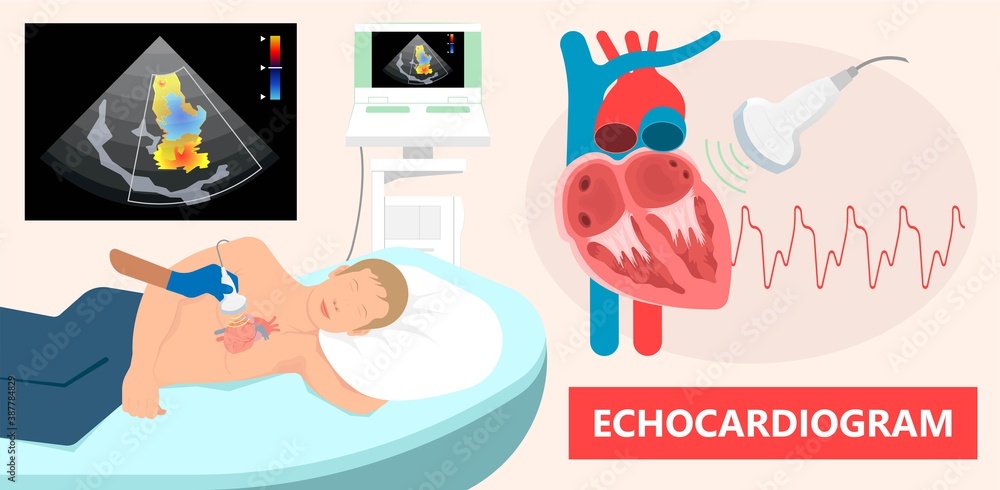 Cath Lab Atrial Septal Defect Tetralogy of Fallot Patent Foramen Ovale ...