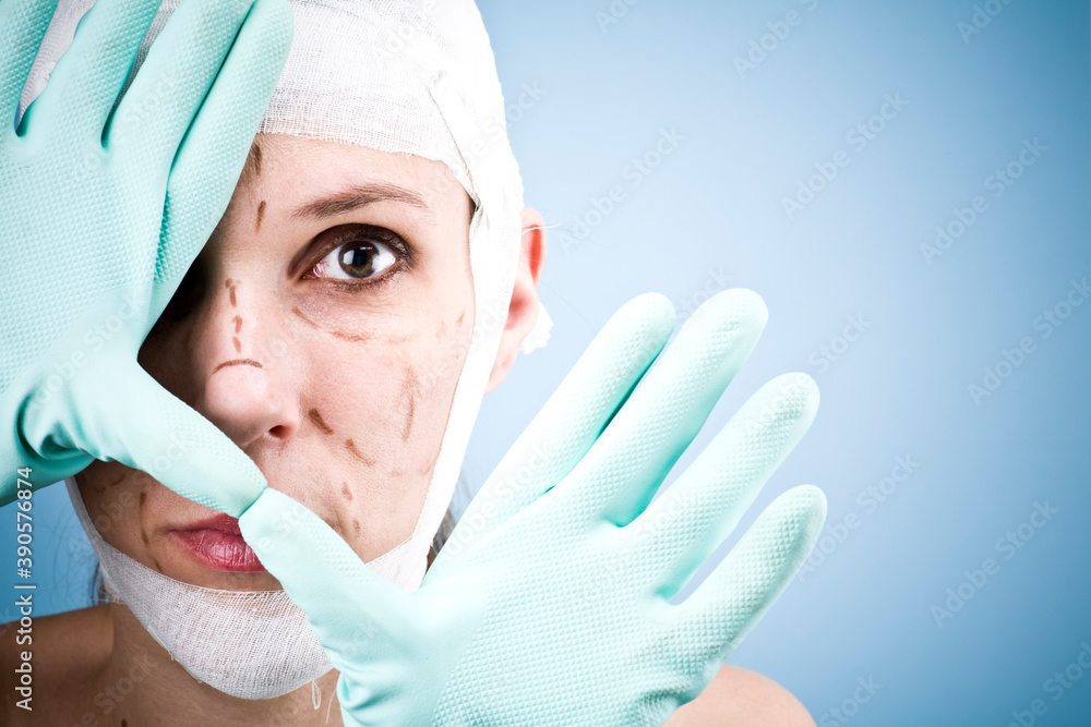Woman's face with correction lines drawn for lifting procedure in ...