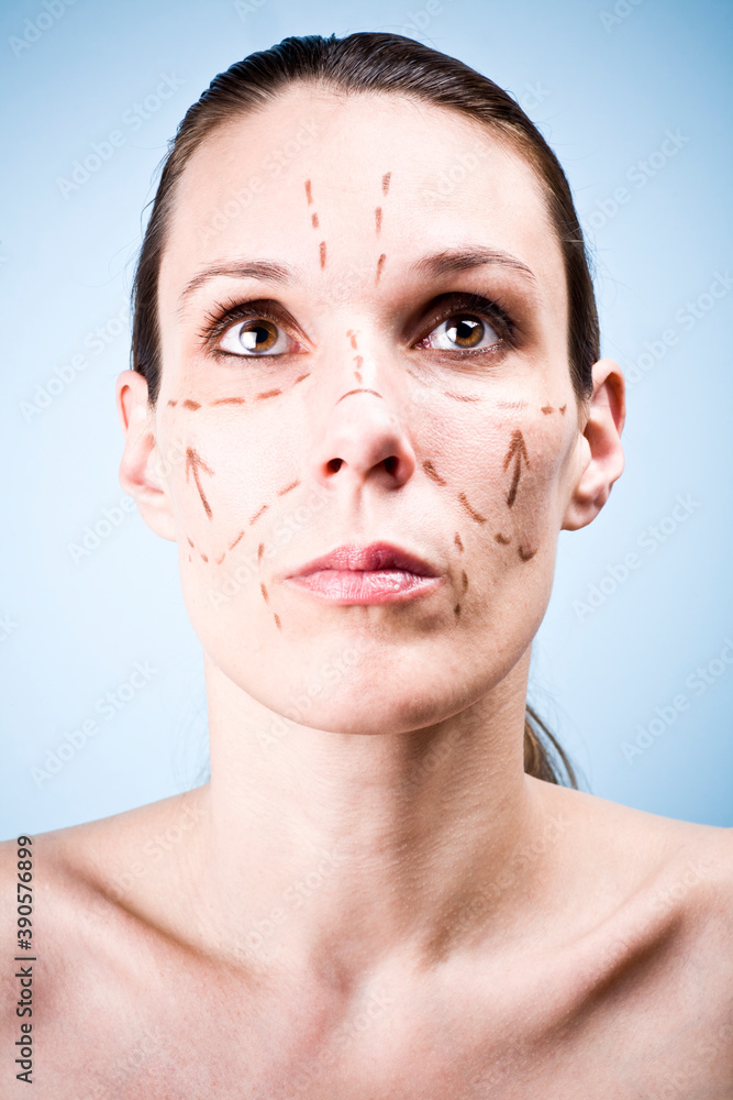 Woman's face with correction lines drawn for lifting procedure in ...