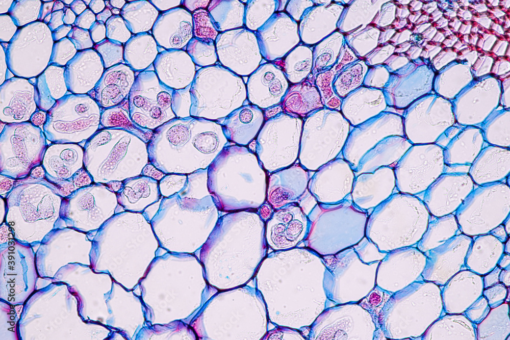 Zygomycota, or zygote fungi ,Downy mildew of cruzifers host tissue with ...