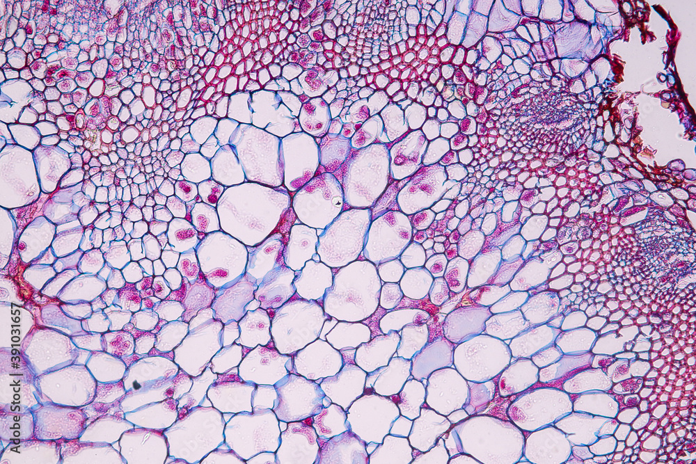 Zygomycota, or zygote fungi ,Downy mildew of cruzifers host tissue with ...