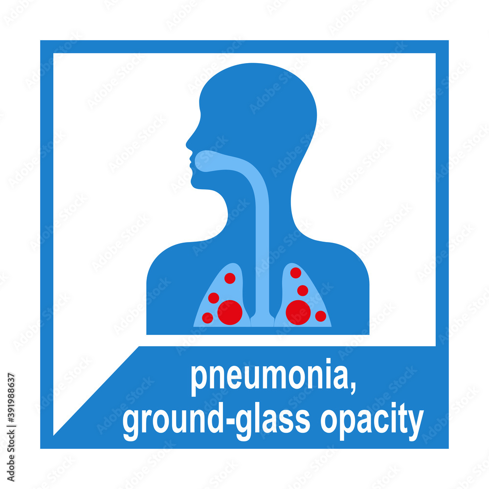 Healthcare infographic elements. Coronavirus symptoms. Pneumonia ...