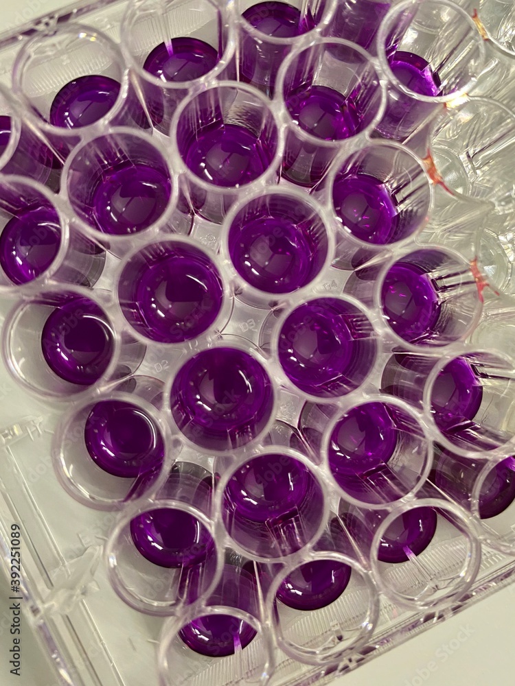 MTT assay for measuring cell viability, proliferation and cytotoxicity ...