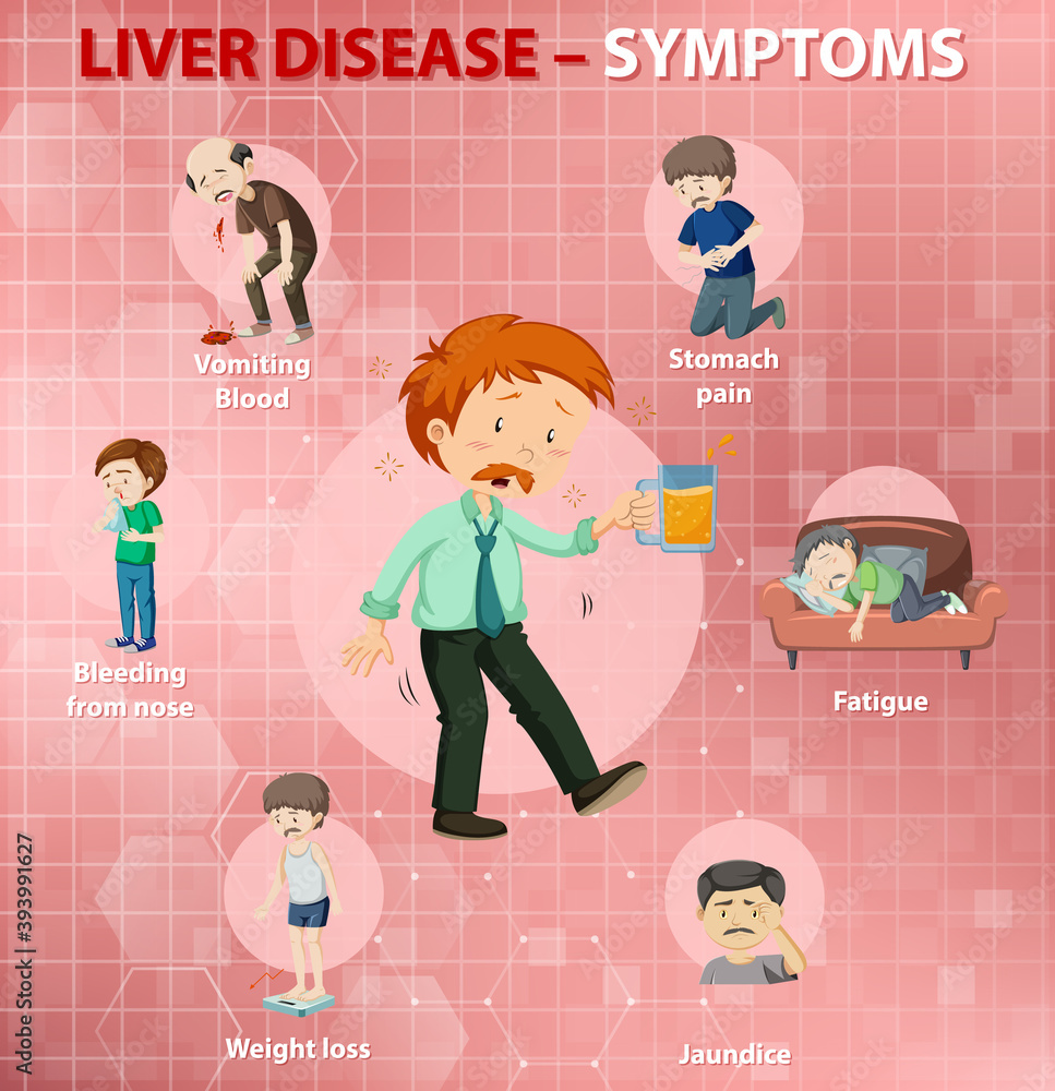 Liver disease symptoms cartoon style cartoon style infographic Stock ...