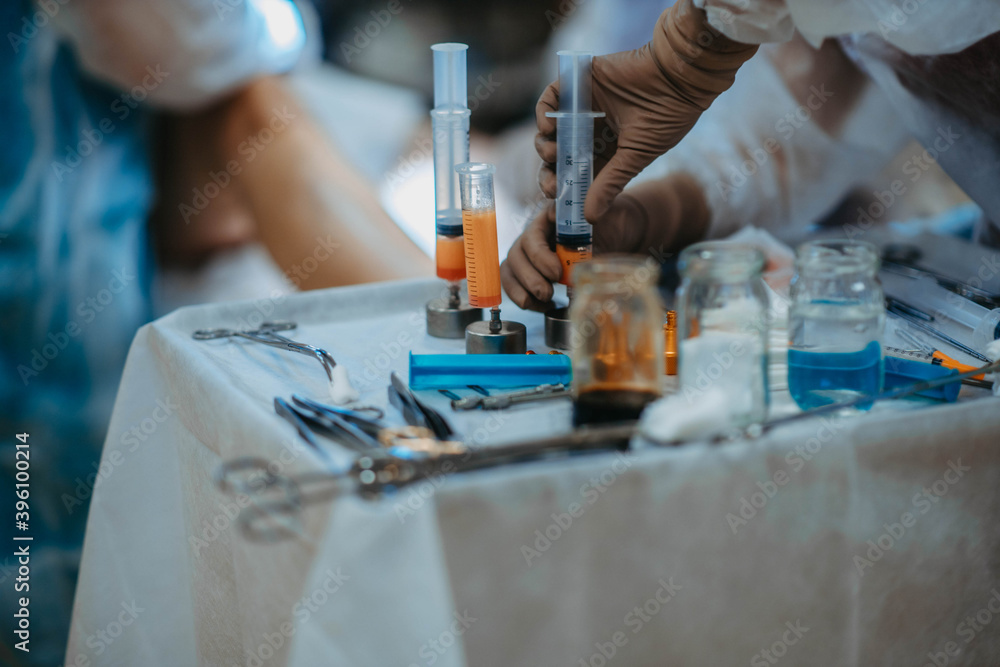 preparation of fat cells for lipofilling in the operating room ...