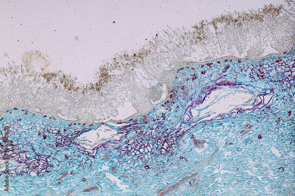 Penicillium, ascomycetous fungi are of major importance in the natural ...
