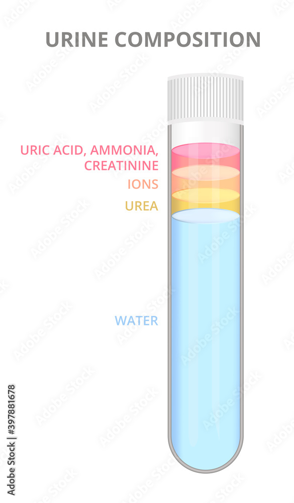 Urine composition, the composition of urine, urine components. Uric ...