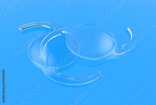 iol intraocular lens cataract ophthalmology Stock Illustration | Adobe ...