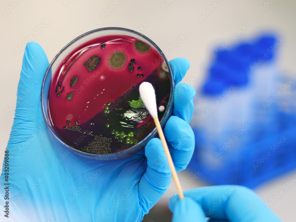 Scientist analysis Escherichia coli (E.coli) culture with Eosin ...