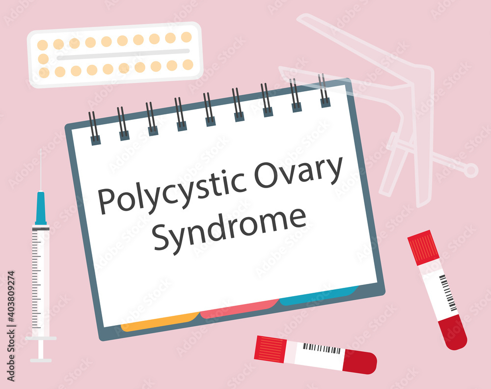 PCOS (Polycystic ovary syndrome) disease concept- vector illustration ...