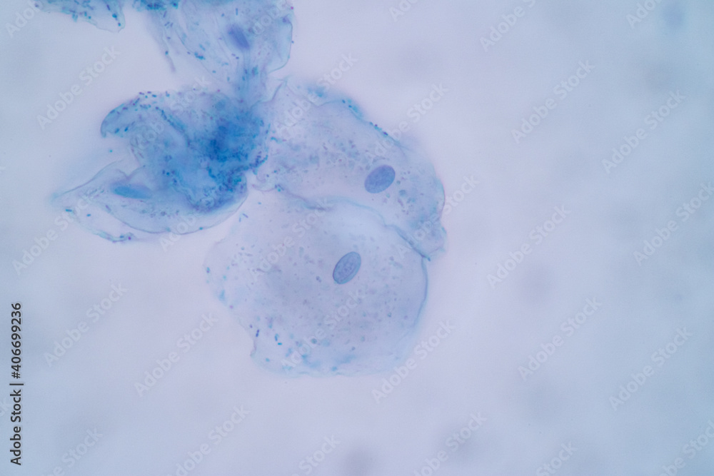 Characteristics of Squamous epithelial cell (Cell structure) of human under microscope view for ...