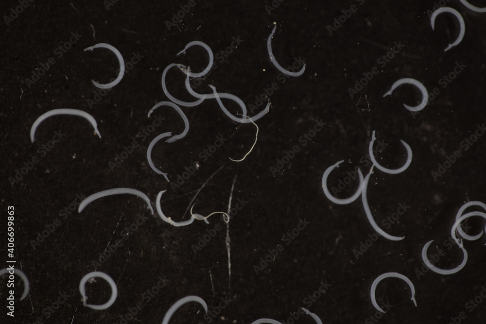 Schistosoma is a genus of trematodes, commonly known as blood flukes ...