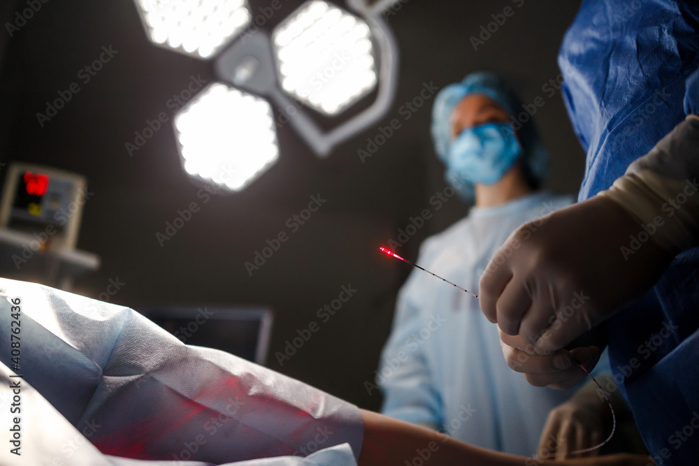 EVLT (endovenous laser treatment) to treat varicose veins. Stock Photo ...