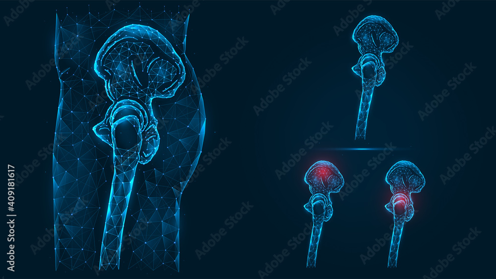 Polygonal illustration of human pelvic and hip bones side view. Disease ...