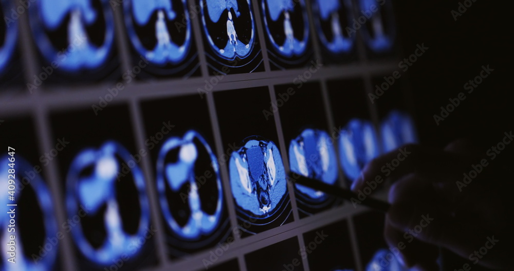 Stock-Foto „Hand pointing out specific picture in CT scan“ | Adobe Stock