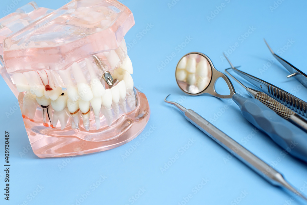 Dentist tools and artificial jaw with prosthesis, caries, pulpitis on a ...