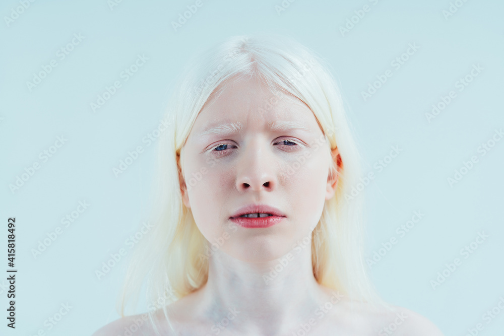 Beauty image of an albino girl posing in studio wearing lingerie ...