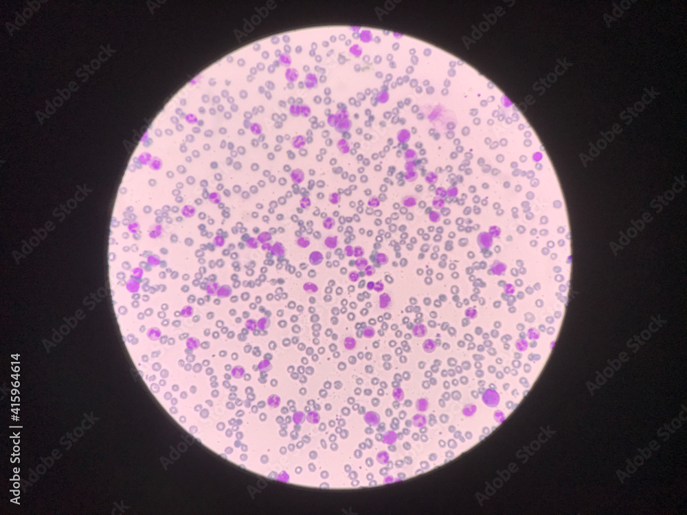 Immature and mature white blood cells.Segmented neutrophil,blast cells ...
