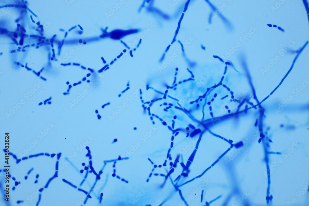 Foto de Stock Microscope of black fungus spore strain with Lactophenol ...