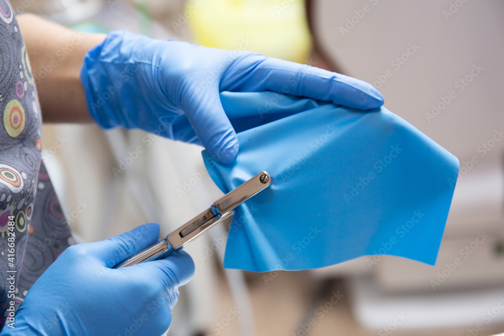 Isolation of the tooth for medical manipulations with a cofferdam ...