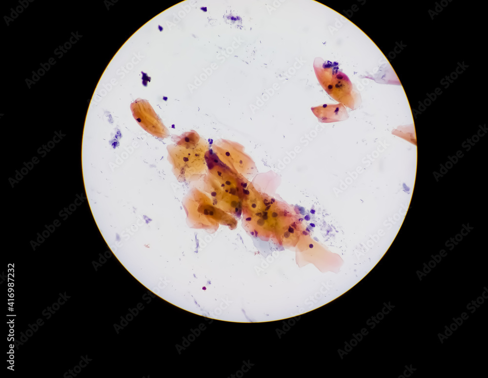 Normal endocervical cells and squamous epithelial cells of cervical ...