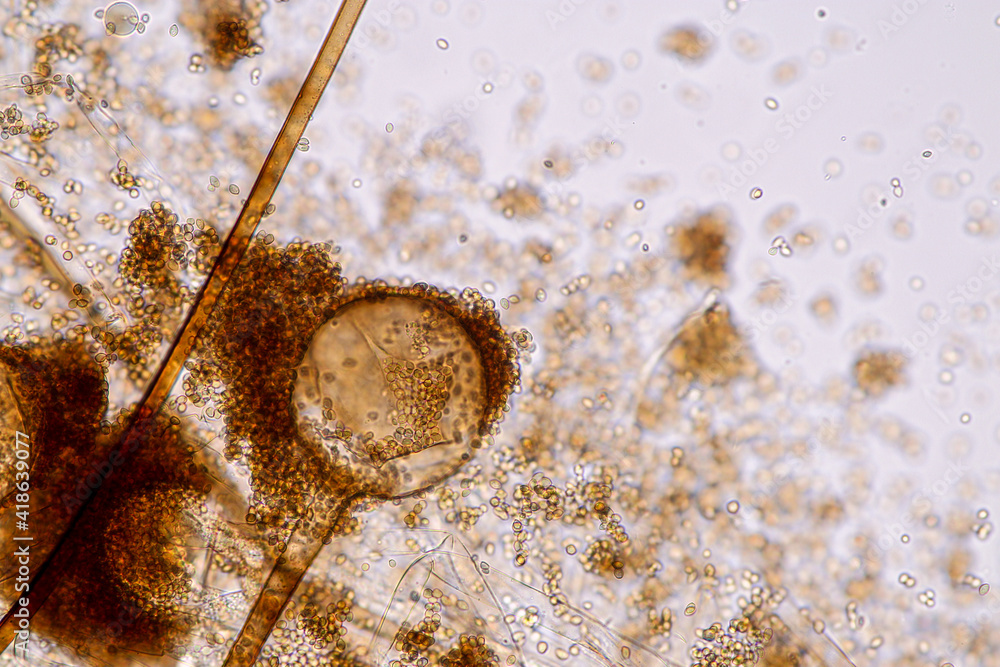 Characteristics of Rhizopus is a genus of common saprophytic fungi on ...