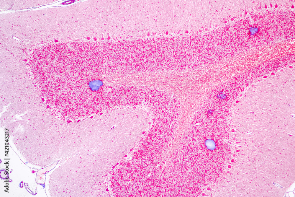 Education Spinal cord, Nerve, Cerebellum, Cortex and Motor Neuron Human ...
