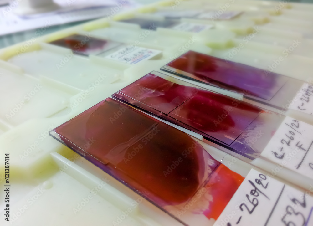 Close view of Histopathology slides stained with leishman stain ...