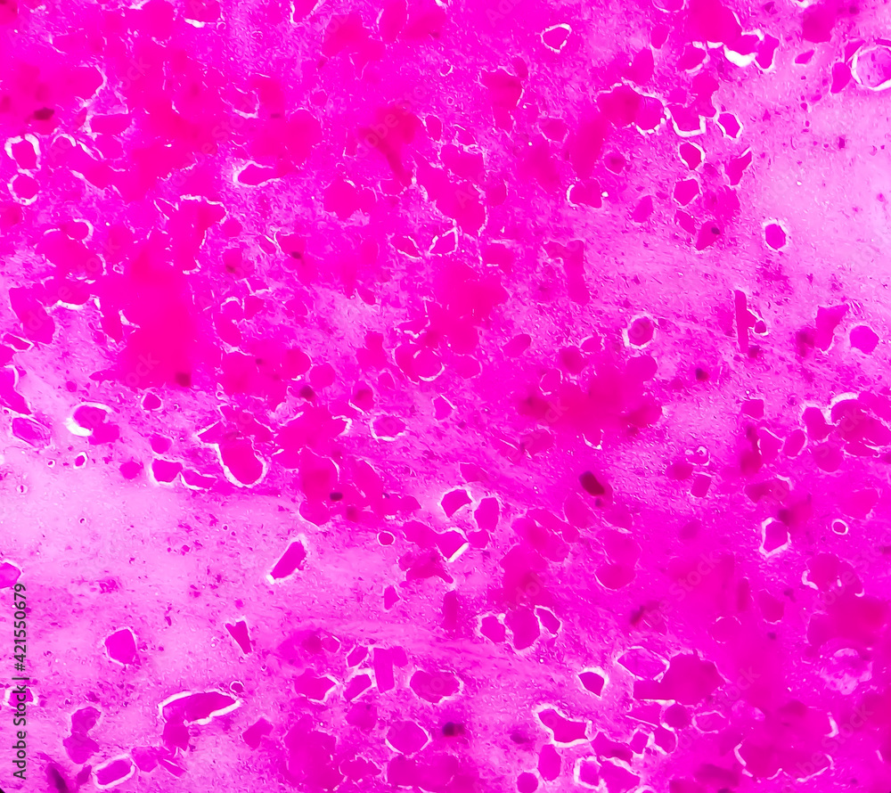 Foto de Stock Microscopic view of Histology stained slide. closeup ...