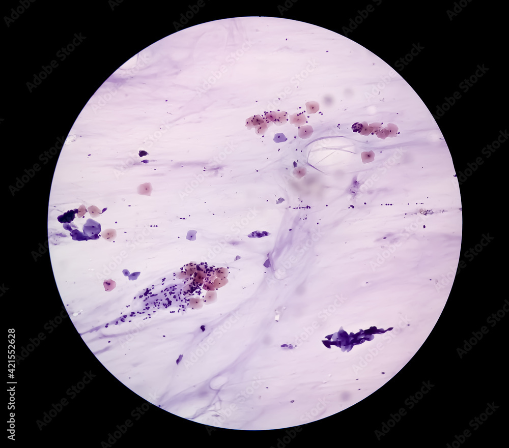 Foto de Stock Microscopic view of Histology stained slide. closeup ...