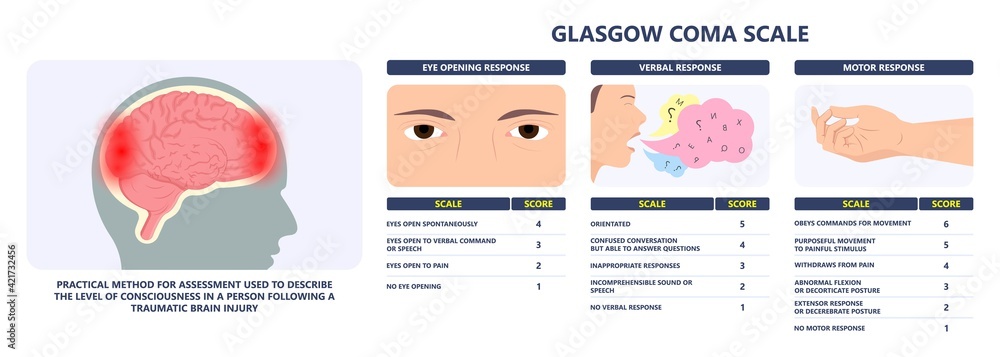 Glasgow Coma Scale avpu alert verbal pain patient score first aid test ...