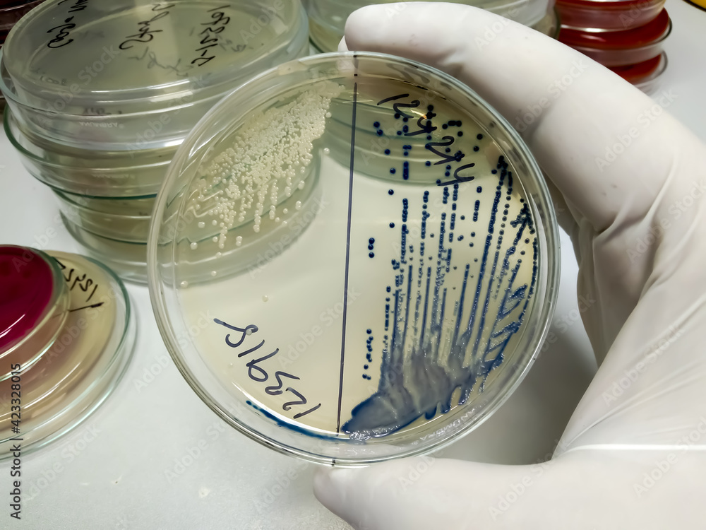 Foto de Stock HiCrome UTI Agar media. For Escherichia coli,Enterobacter ...