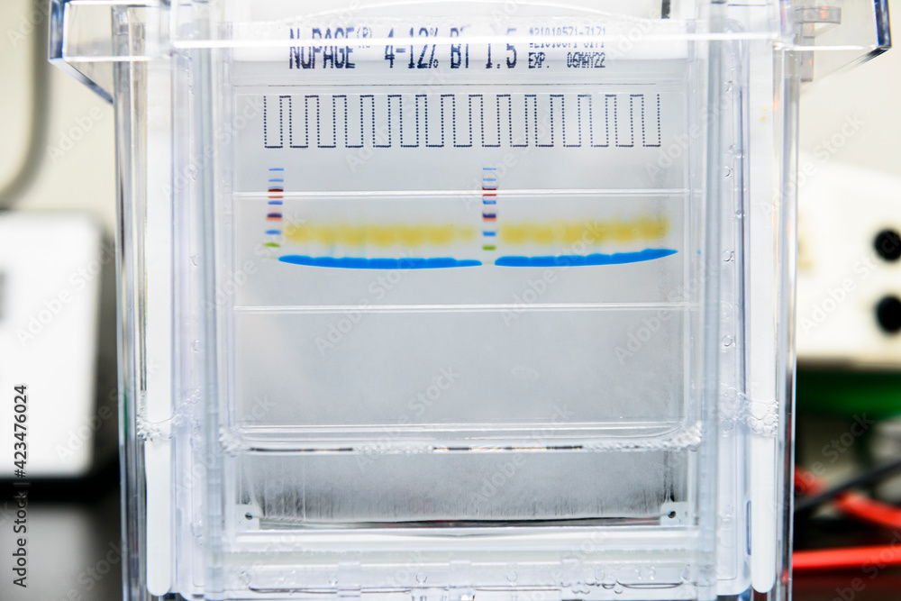 Protein ladder and protein samples on SDS-PAGE for interesting protein ...