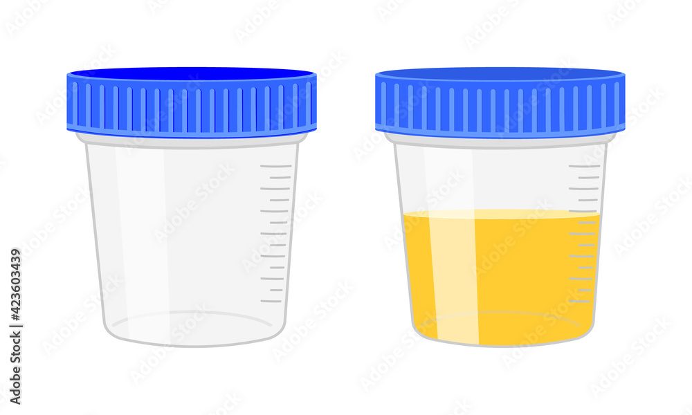 Urinalysis. Urine sample, empty and full plastic containers. Laboratory ...