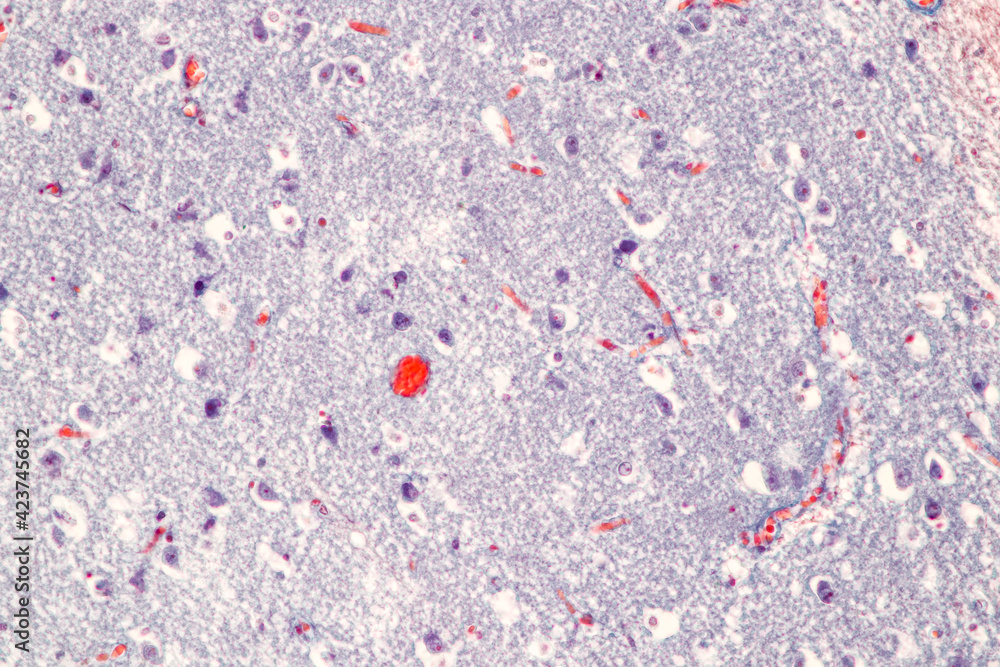 Education Spinal cord, Nerve, Cerebellum, Cortex and Motor Neuron Human ...