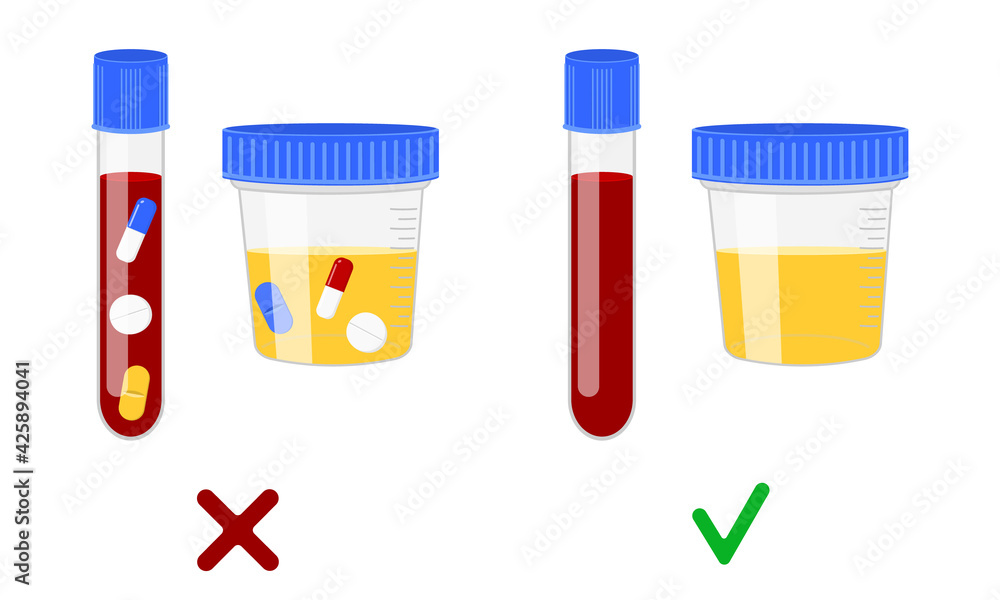 Blood and urine samples with and without different drugs. Doping ...