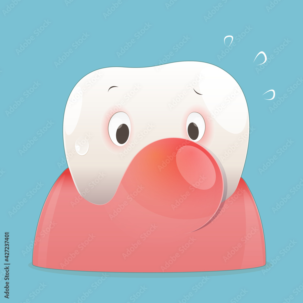 Periodontal disease illustration. Cartoon periodontitis disease Stock ...