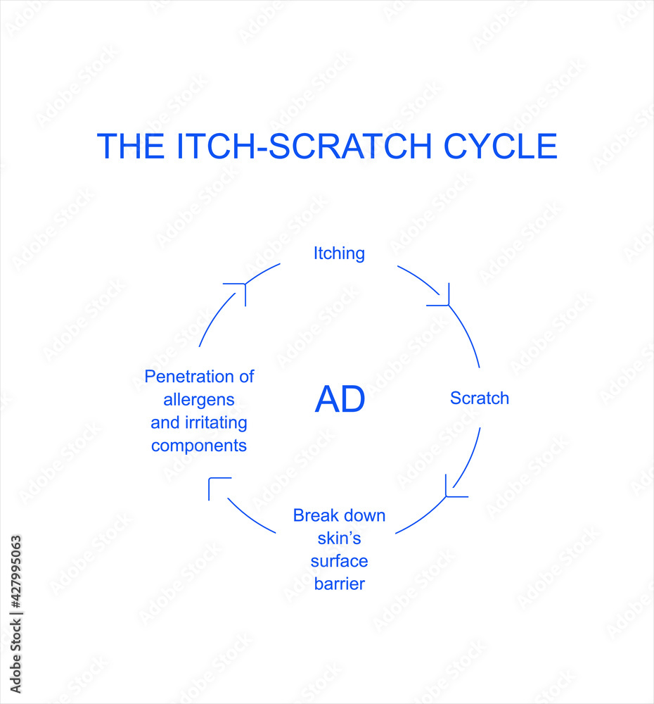Atopic dermatitis itch-scratch cycle conditions. Eczema-prone skin ... Atopic dermatitis itch-scratch cycle conditions. Eczema-prone skin ...