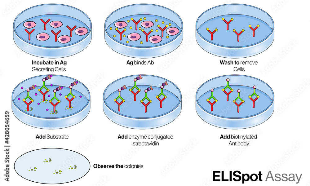 Protocol of Steps involved in Eli Spot assay, Principle of Eli spot ...