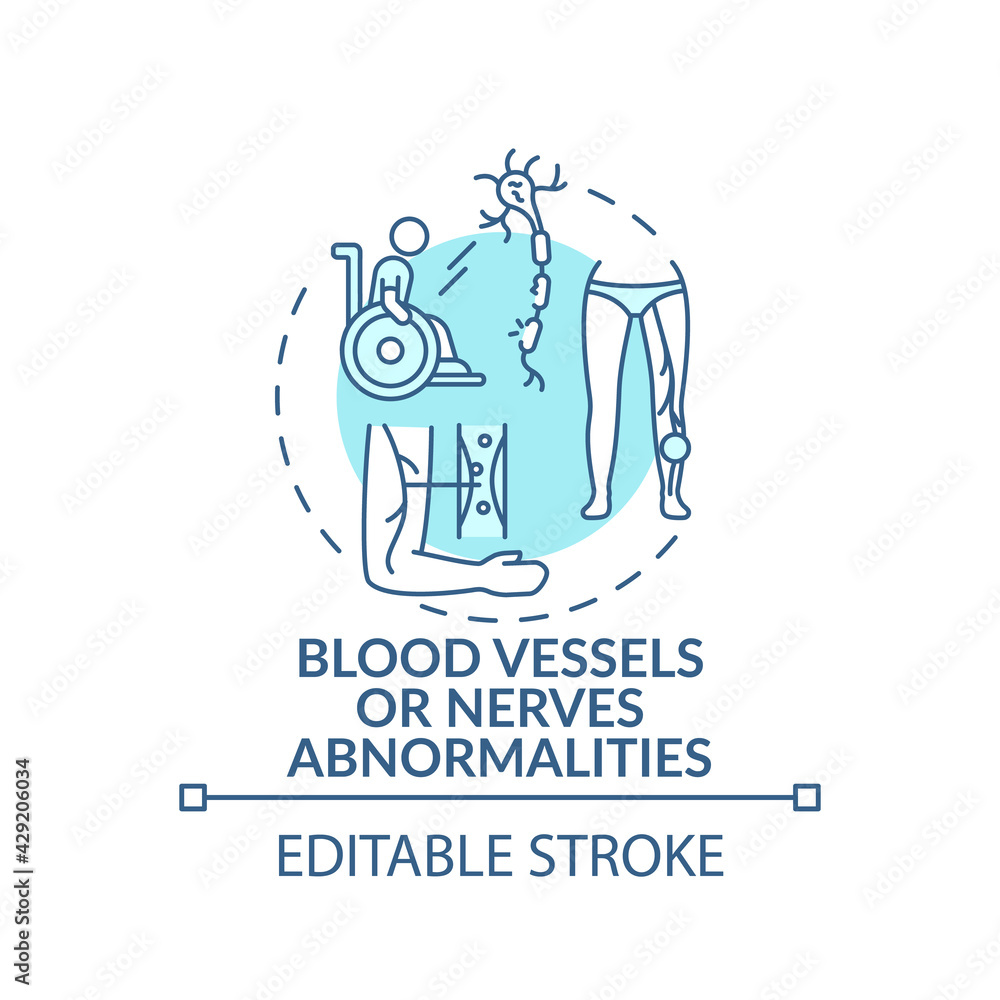 Blood vessels and nerves abnormalities concept icon. Amputation idea ...