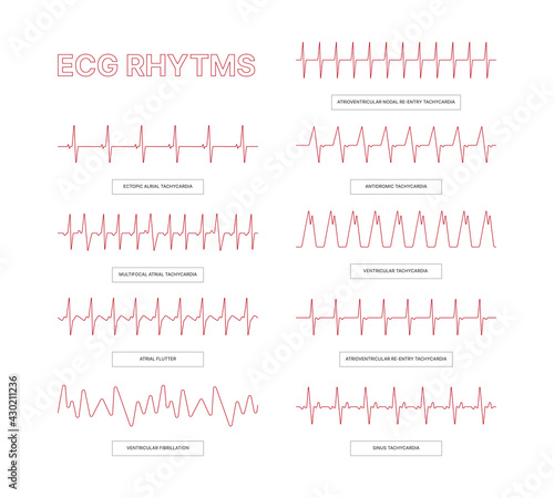 Ecg templates. Medical infographic lines heart arrhythmia health ...