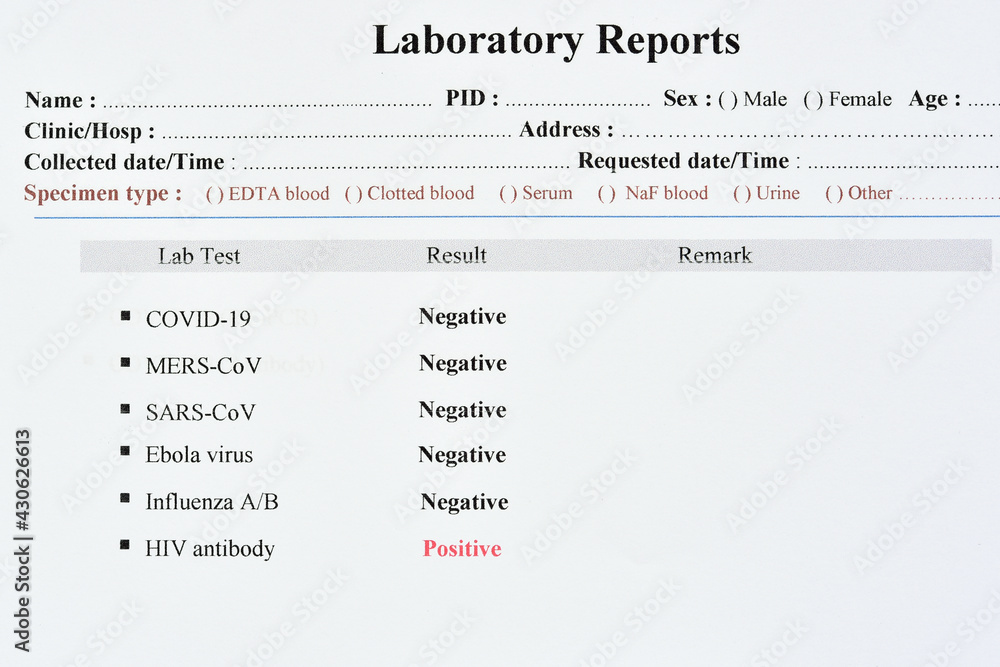 Laboratory report of infection disease, COVID-19, MERS, SARS, Ebola ...