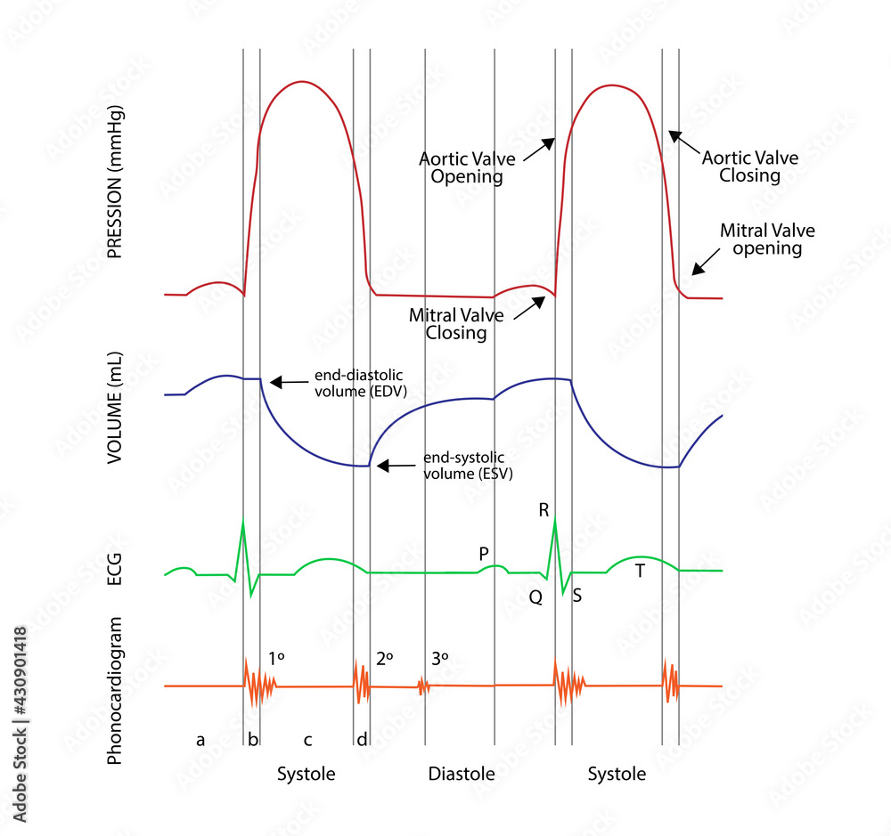 Left ventricular pressure-volume (PV) loops, electrocardiogram (ECG ...