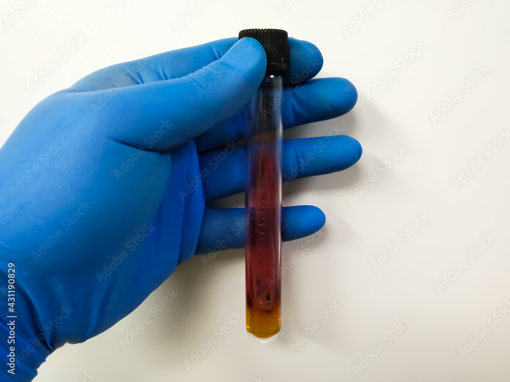 Fermentation reaction and hydrogen sulfide production in Triple sugar ...