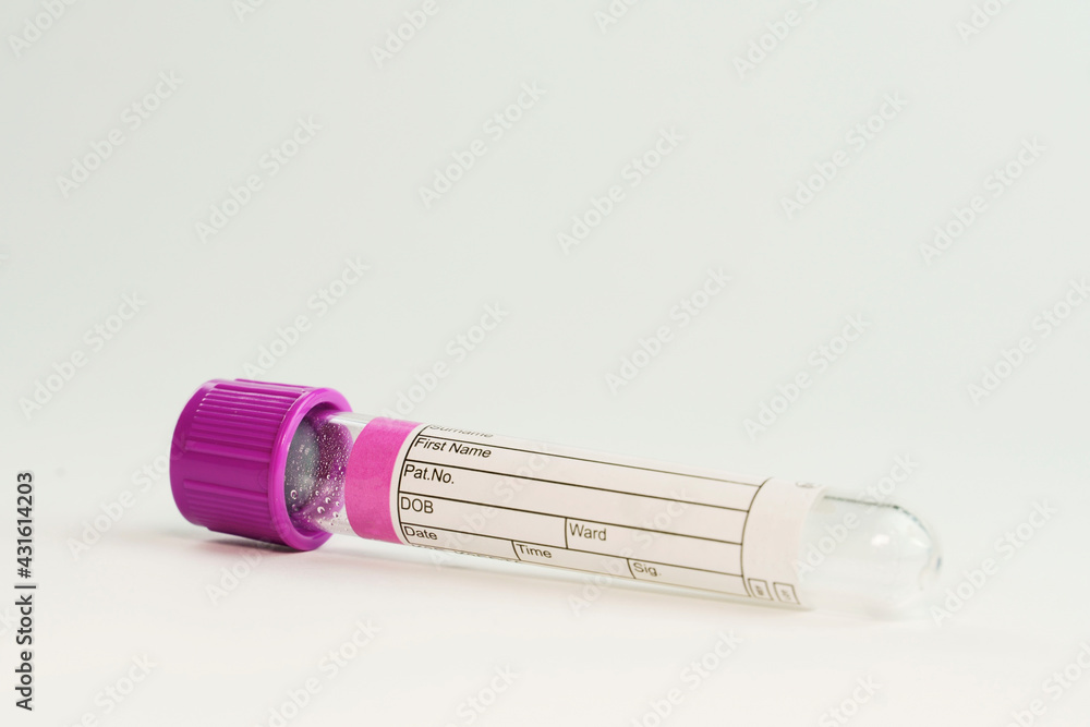 vacuum tube for collection and blood samples on white background ...