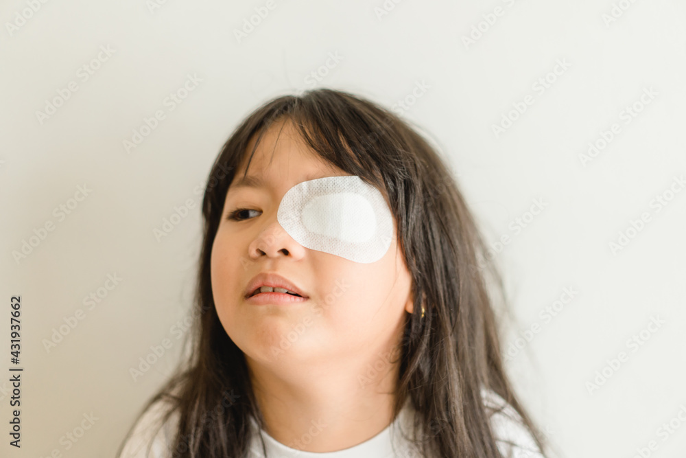Lazy Eye amblyopia in children.Eye care.Little asian girl covered up ...