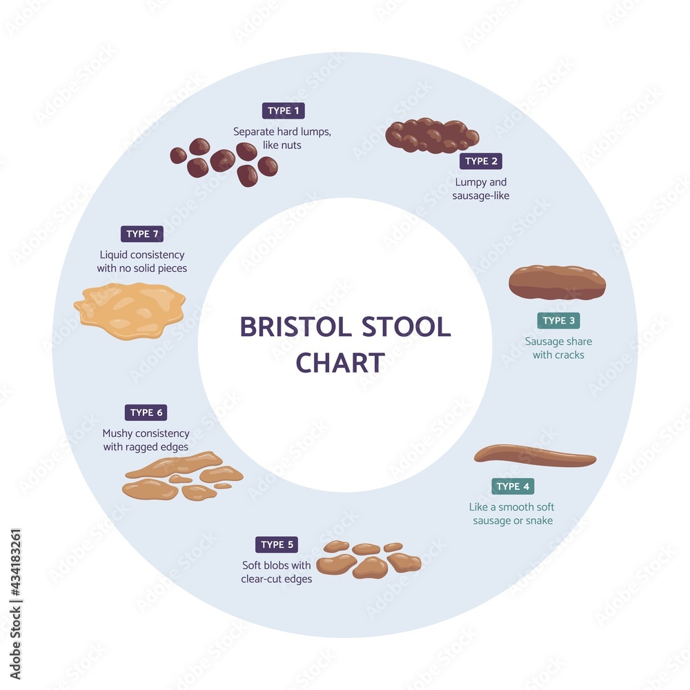 Bristol stool chart infographic, flat vector illustration isolated on ...